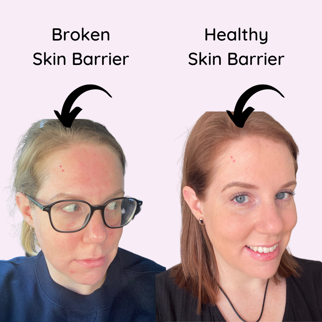 Emily Luise Skin - Hypoallergenic products for the skin barrier.